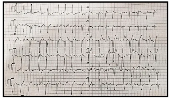 The possibility of catching severe COVID-19 disease with cardio-renal ...